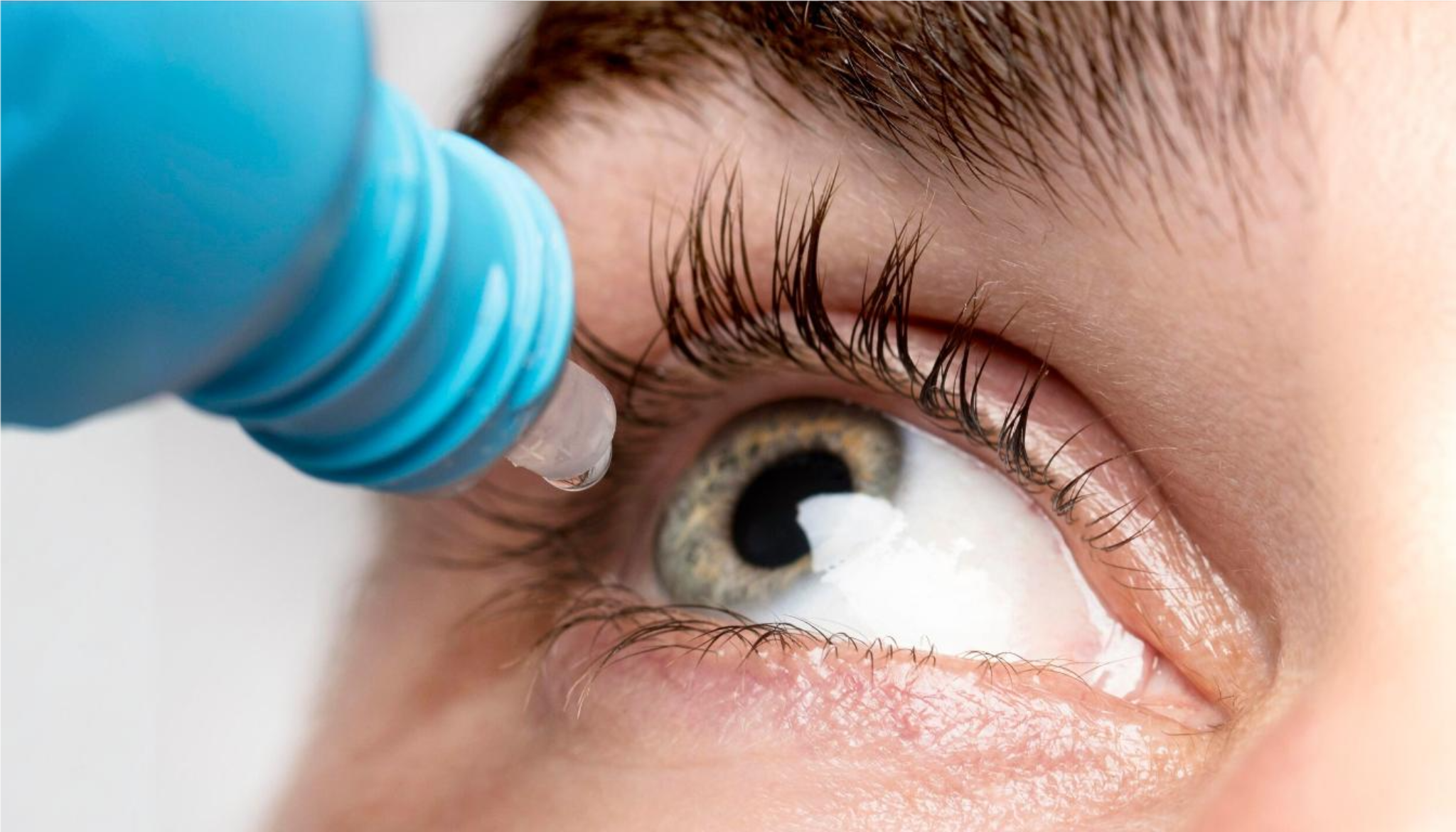 Myth Busted: The Relation of Tears and Dry Eyes - Associate ...